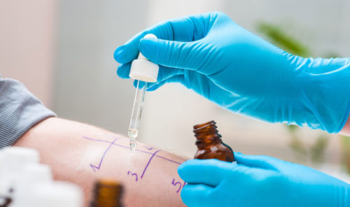 How to Prepare for Your Allergy Test - Useful Tips from AAOA